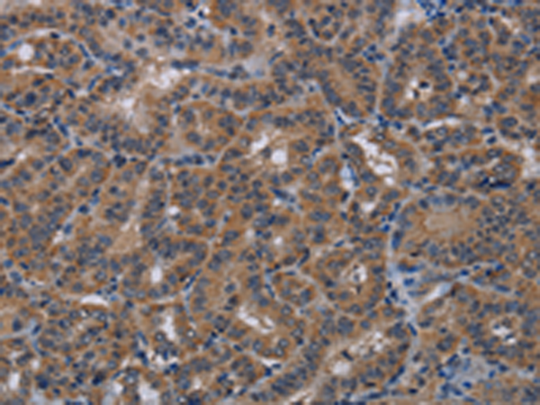 兔抗PDE4A多克隆抗体,Anti-PDE4A rabbit polyclonal antibody 生命科学产品与技术服务-生工生物工程 ...
