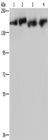 兔抗PLCB3多克隆抗体,Anti-PLCB3 rabbit polyclonal antibody 生命科学产品与技术服务-生工生物工程 ...