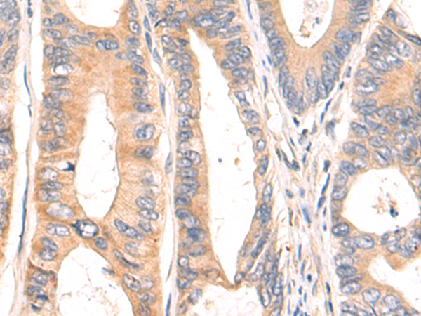 兔抗SDHB多克隆抗体,Anti-SDHB rabbit polyclonal antibody 生命科学产品与技术服务-生工生物工程(上海)股份有限公司