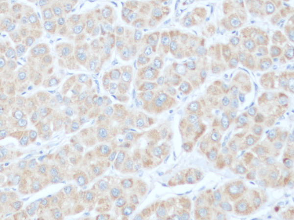兔抗SLC5A11多克隆抗体,Anti-SLC5A11 rabbit polyclonal antibody 生命科学产品与技术服务-生工生物 ...