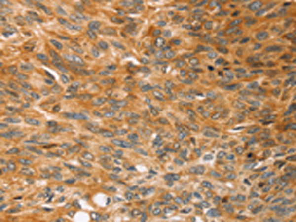 兔抗SOX11多克隆抗体,Anti-SOX11 rabbit polyclonal antibody 生命科学产品与技术服务-生工生物工程 ...