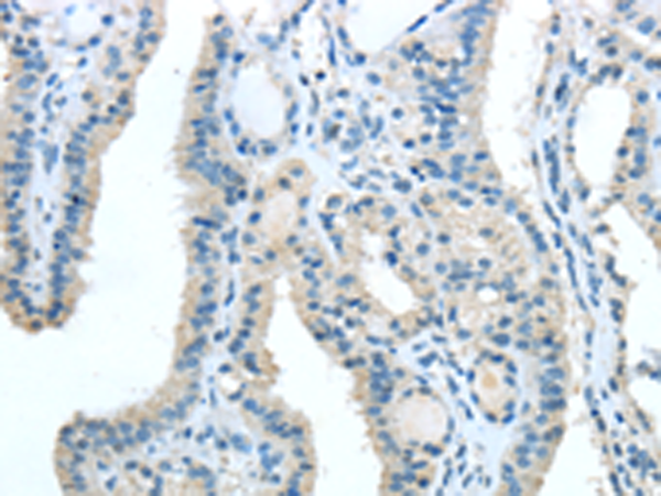 兔抗trib1多克隆抗体anti Trib1 Rabbit Polyclonal Antibody 生命科学产品与技术服务 生工生物工程
