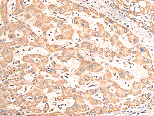 兔抗COX4I1多克隆抗体,Anti-COX4I1 rabbit polyclonal antibody 生命科学产品与技术服务-生工生物工程 ...