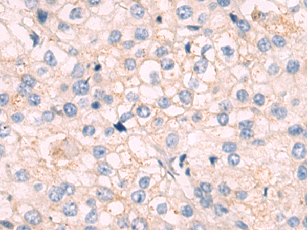 兔抗COLEC12多克隆抗体,Anti-COLEC12 rabbit polyclonal antibody 生命科学产品与技术服务-生工生物 ...