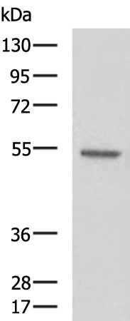 兔抗GFAP多克隆抗体,Anti-GFAP rabbit polyclonal antibody 生命科学产品与技术服务-生工生物工程(上海 ...
