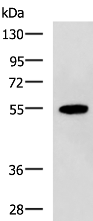兔抗F2RL1多克隆抗体,Anti-F2RL1 rabbit polyclonal antibody 生命科学产品与技术服务-生工生物工程 ...