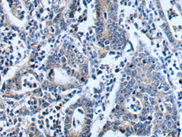 兔抗cntfr多克隆抗体anti Cntfr Rabbit Polyclonal Antibody 生命科学产品与技术服务 生工生物工程