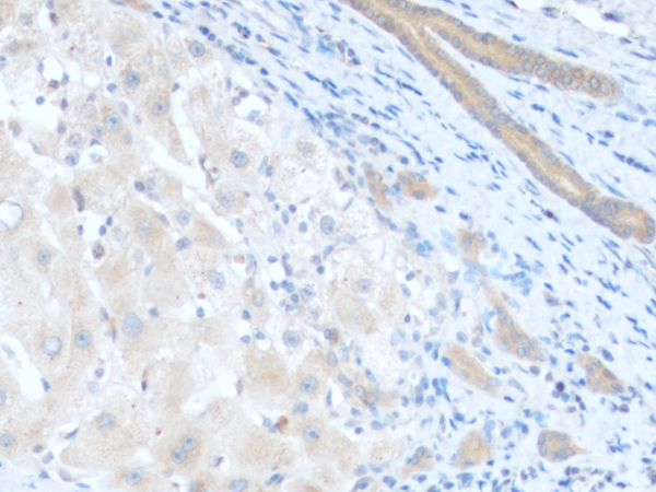 兔抗IFNB1多克隆抗体,Anti-IFNB1 rabbit polyclonal antibody 生命科学产品与技术服务-生工生物工程 ...