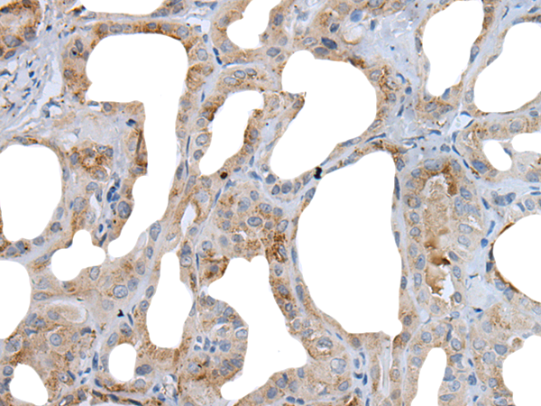 兔抗JAK3多克隆抗体,Anti-JAK3 rabbit polyclonal antibody 生命科学产品与技术服务-生工生物工程(上海 ...