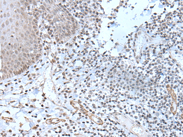 兔抗zbtb11多克隆抗体anti Zbtb11 Rabbit Polyclonal Antibody 生命科学产品与技术服务 生工生物工程