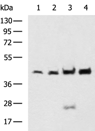 兔抗DSCC1多克隆抗体,Anti-DSCC1 rabbit polyclonal antibody 生命科学产品与技术服务-生工生物工程 ...