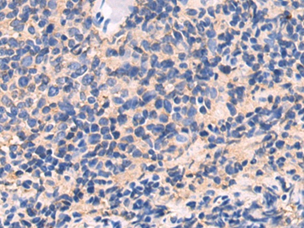 兔抗HLA-DRA多克隆抗体,Anti-HLA-DRA rabbit polyclonal antibody 生命科学产品与技术服务-生工生物 ...