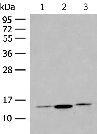 兔抗HBB多克隆抗体,Anti-HBB rabbit polyclonal antibody 生命科学产品与技术服务-生工生物工程(上海)股份有限公司