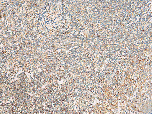 兔抗hadh多克隆抗体anti Hadh Rabbit Polyclonal Antibody 生命科学产品与技术服务 生工生物工程上海