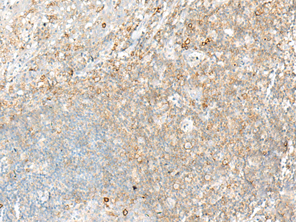 兔抗HLA-DRB1多克隆抗体,Anti-HLA-DRB1 rabbit polyclonal antibody 生命科学产品与技术服务-生工 ...