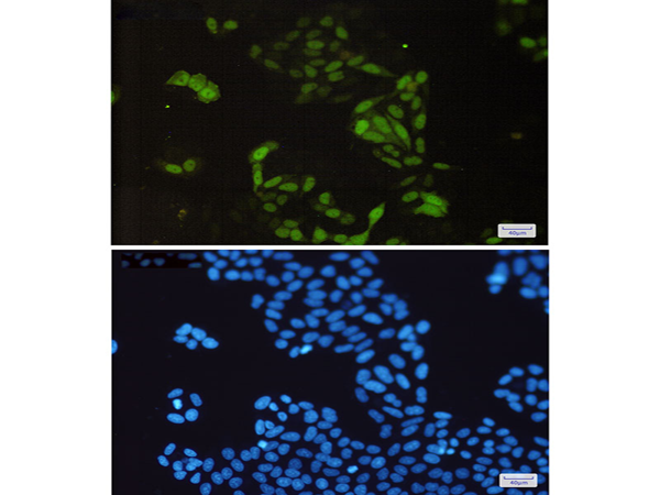 兔抗ccna2单克隆抗体anti Ccna2 Rabbit Monoclonal Antibody 生命科学产品与技术服务 生工生物工程