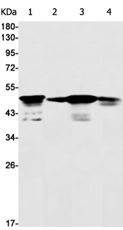 兔抗CCNA2单克隆抗体,Anti-CCNA2 rabbit monoclonal antibody 生命科学产品与技术服务-生工生物工程 ...