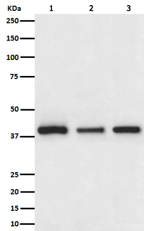 兔抗CTSL/CTSV/CTSK/CTSH单克隆抗体,Anti-CTSL/CTSV/CTSK/CTSH rabbit monoclonal ...