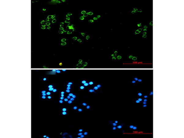 兔抗dld单克隆抗体anti Dld Rabbit Monoclonal Antibody 生命科学产品与技术服务 生工生物工程上海股份有限公司