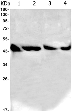 兔抗GOT1单克隆抗体,Anti-GOT1 rabbit monoclonal antibody 生命科学产品与技术服务-生工生物工程(上海 ...