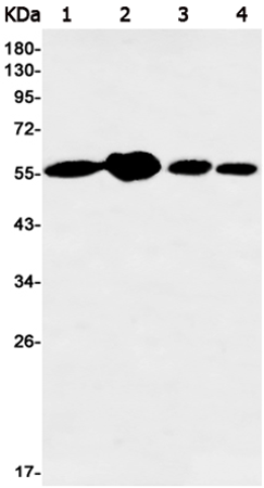 兔抗GSDME单克隆抗体,Anti-GSDME rabbit monoclonal antibody 生命科学产品与技术服务-生工生物工程 ...