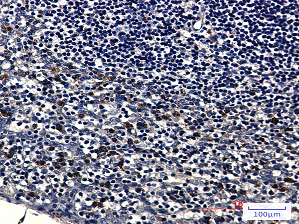 兔抗Human kappa Light Chain单克隆抗体,Anti-Human kappa Light Chain rabbit ...