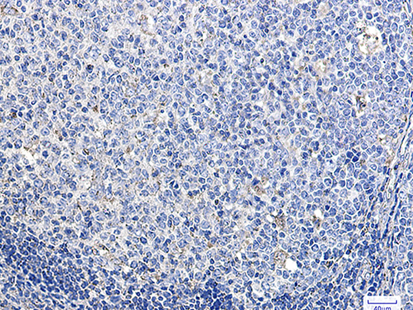兔抗lamp1单克隆抗体anti Lamp1 Rabbit Monoclonal Antibody 生命科学产品与技术服务 生工生物工程