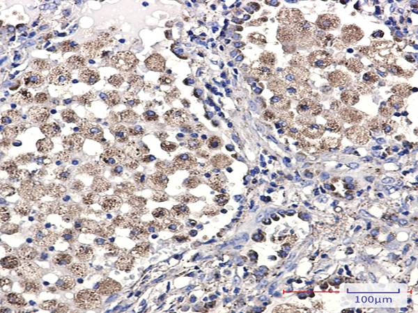 兔抗lamp2单克隆抗体anti Lamp2 Rabbit Monoclonal Antibody 生命科学产品与技术服务 生工生物工程
