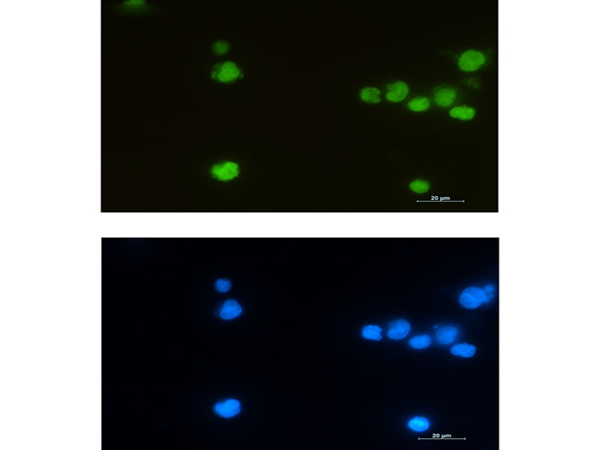兔抗lef1单克隆抗体anti Lef1 Rabbit Monoclonal Antibody 生命科学产品与技术服务 生工生物工程上海