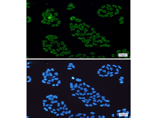兔抗LMNA单克隆抗体,Anti-LMNA rabbit monoclonal antibody 生命科学产品与技术服务-生工生物工程(上海 ...