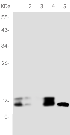 兔抗MAP1LC3A单克隆抗体,Anti-MAP1LC3A rabbit monoclonal antibody 生命科学产品与技术服务-生工 ...