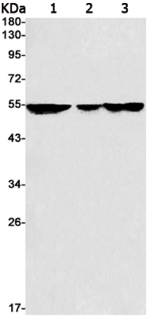 兔抗MMP3单克隆抗体,Anti-MMP3 rabbit monoclonal antibody 生命科学产品与技术服务-生工生物工程(上海 ...