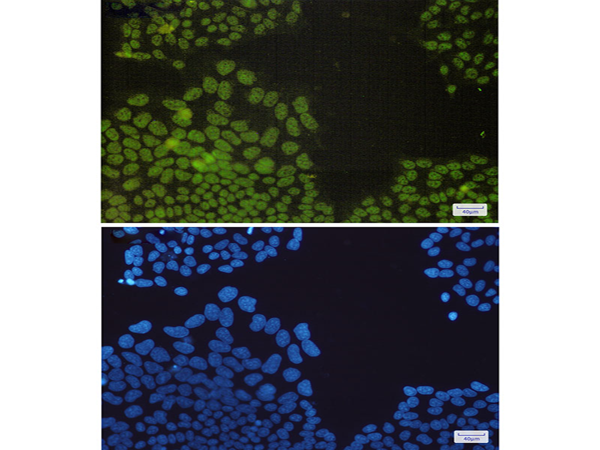 兔抗nrf1单克隆抗体anti Nrf1 Rabbit Monoclonal Antibody 生命科学产品与技术服务 生工生物工程上海