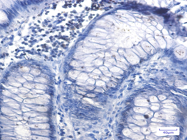 兔抗nrf1单克隆抗体anti Nrf1 Rabbit Monoclonal Antibody 生命科学产品与技术服务 生工生物工程上海