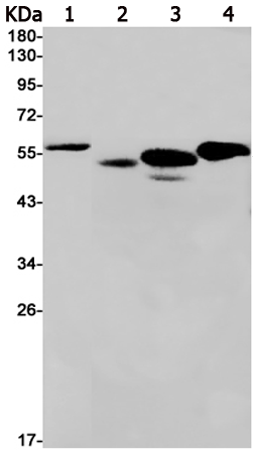 兔抗PNPLA2单克隆抗体,Anti-PNPLA2 rabbit monoclonal antibody 生命科学产品与技术服务-生工生物工程(上海)股份有限公司