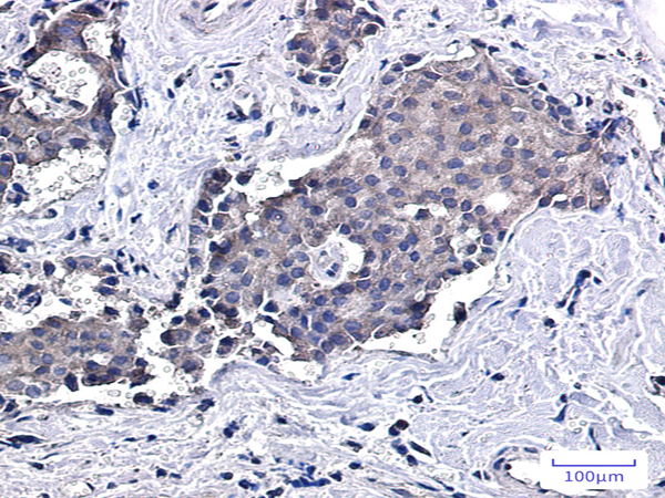 兔抗rack1单克隆抗体anti Rack1 Rabbit Monoclonal Antibody 生命科学产品与技术服务 生工生物工程