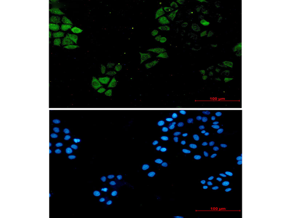 兔抗s100a4单克隆抗体anti S100a4 Rabbit Monoclonal Antibody 生命科学产品与技术服务 生工生物工程