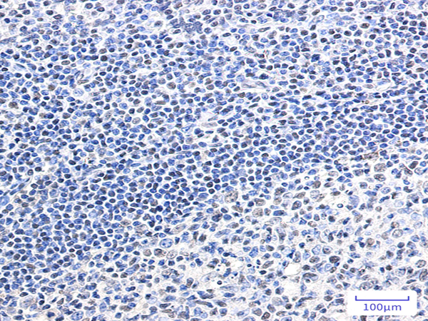 兔抗srsf2单克隆抗体anti Srsf2 Rabbit Monoclonal Antibody 生命科学产品与技术服务 生工生物工程