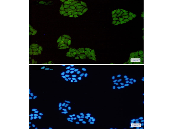 兔抗stat1单克隆抗体anti Stat1 Rabbit Monoclonal Antibody 生命科学产品与技术服务 生工生物工程