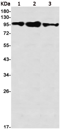 兔抗TPX2单克隆抗体,Anti-TPX2 rabbit monoclonal antibody 生命科学产品与技术服务-生工生物工程(上海 ...