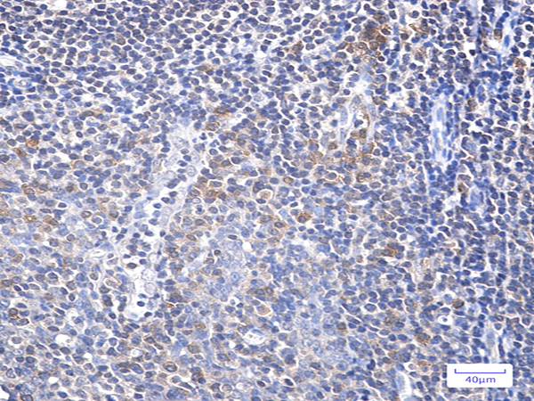 兔抗ufc1单克隆抗体anti Ufc1 Rabbit Monoclonal Antibody 生命科学产品与技术服务 生工生物工程上海