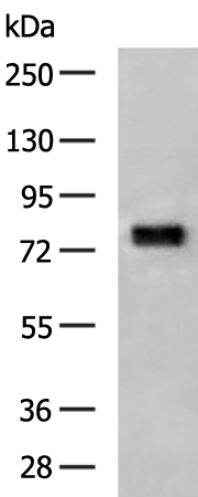 兔抗FSHR多克隆抗体,Anti-FSHR rabbit polyclonal antibody 生命科学产品与技术服务-生工生物工程(上海 ...