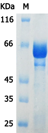 人VIM抗原（重组蛋白）,Human VIM Antigen (Recombinant Protein) 生命科学产品与技术服务-生工生物工程 ...