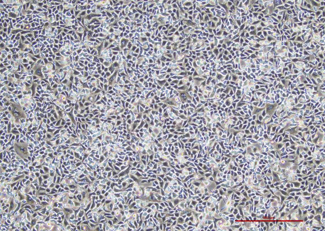 人非小细胞肺癌细胞(A549)，STR鉴定正确，冻存细胞,A549 Cells, correctly identified by STR 生命 ...