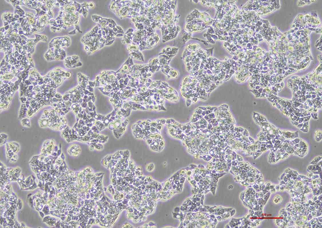 人肝癌细胞(HEPG2)，STR鉴定正确，常温细胞,HEPG2 Cells, correctly identified by STR 生命科学产品与技术服务-生工生物工程(上海)股份有限公司