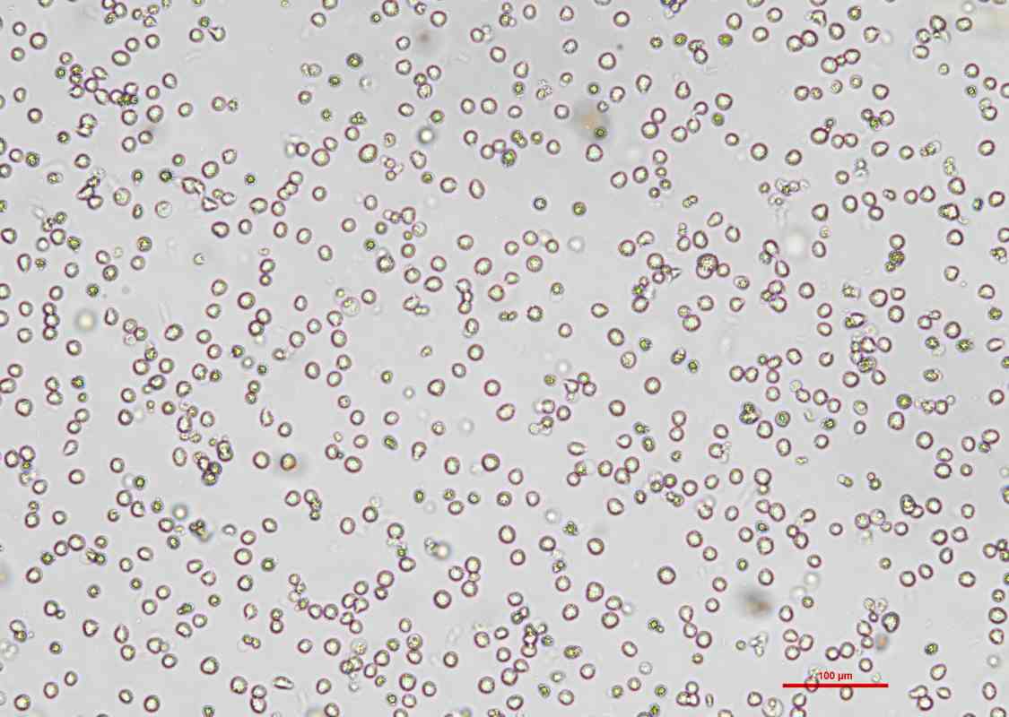 人原髓细胞白血病细胞(HL-60),STR鉴定正确，常温细胞 ,HL-60 Cells, correctly identified by STR 生命科学产品与技术服务-生工生物工程(上海 ...