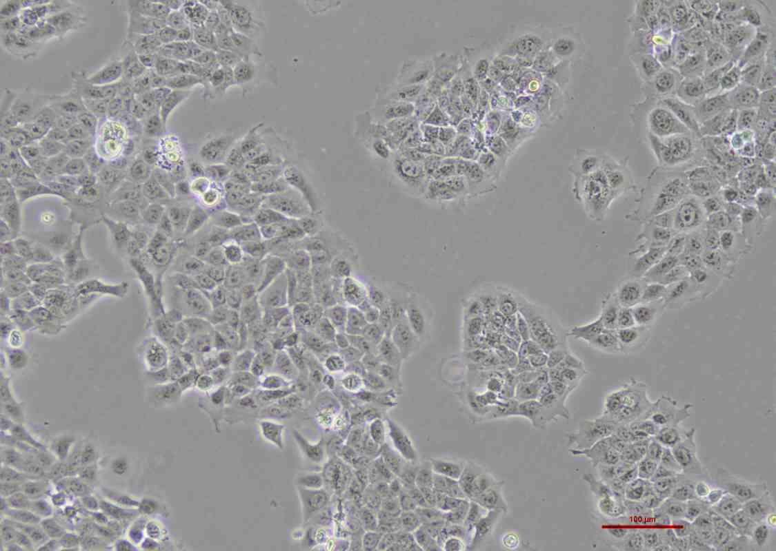 人角质形成细胞(Hacat)，STR鉴定正确，常温细胞,Hacat Cells, correctly identified by STR 生命 ...