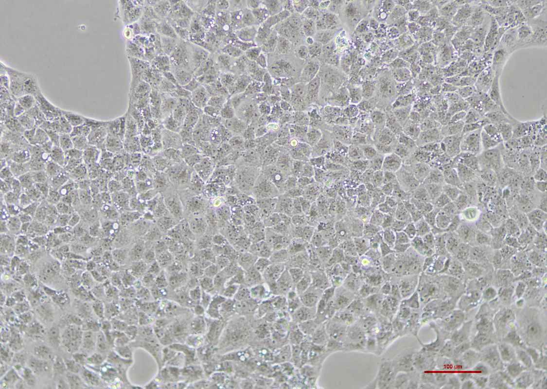 人肾皮质近曲小管上皮细胞(HK-2)，STR鉴定正确，冻存细胞,HK-2 Cells, correctly identified by STR 生命科学产品与技术服务-生工生物工程(上海)股份有限公司