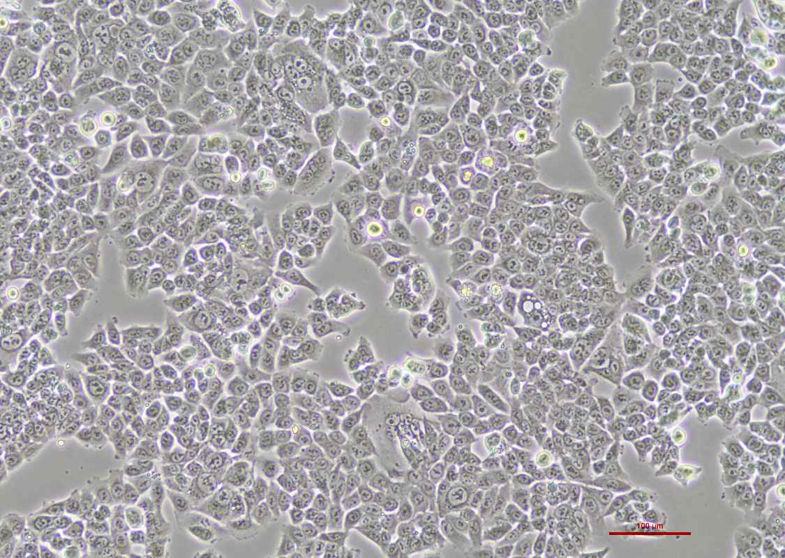 人结肠癌细胞(hct116)，STR鉴定正确，常温细胞,hct116 Cells, correctly identified by STR 生命科学产品与技术服务-生工生物工程(上海)股份有限公司