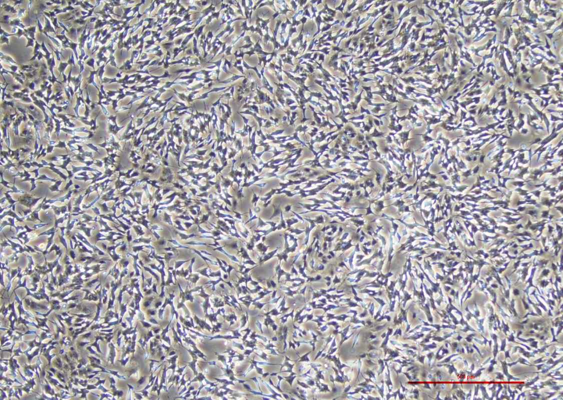 人神经母细胞瘤细胞(SH-SY5Y)，STR鉴定正确，常温细胞,SH-SY5Y Cells, correctly identified by STR 生命科学产品与技术服务-生工生物工程(上海 ...